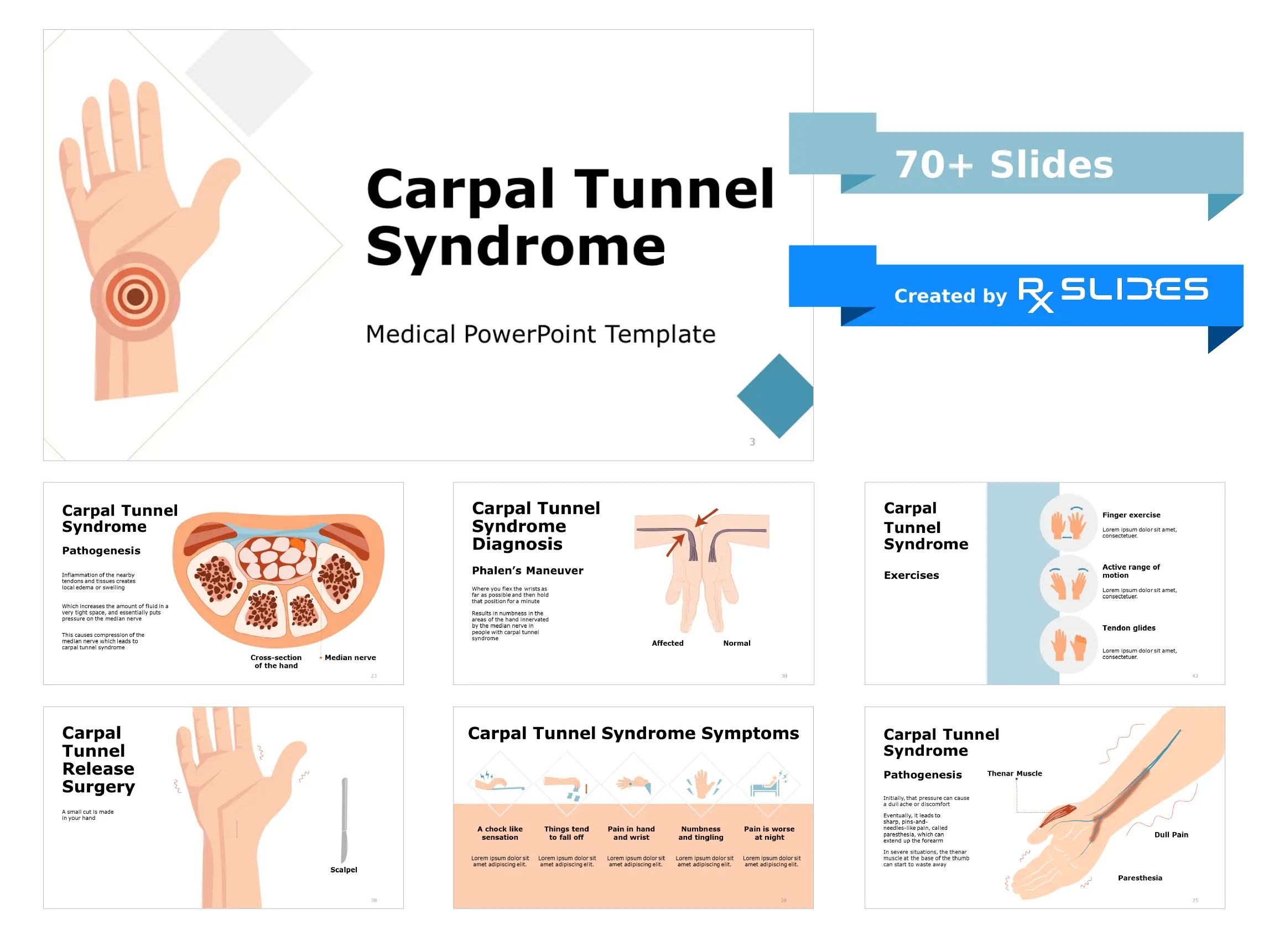 Download Carpal Tunnel Syndrome PowerPoint Template|RxSlides